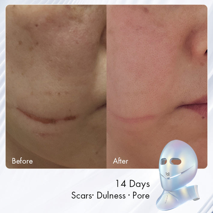 The Radiance Kit – LED Face & Neck Masks – CHOUCHOU TOKYO